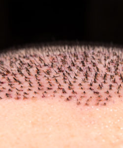 Benefits of OxyCure therapy – OxyCure Therapy