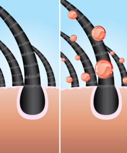 Benefits of OxyCure therapy – OxyCure Therapy